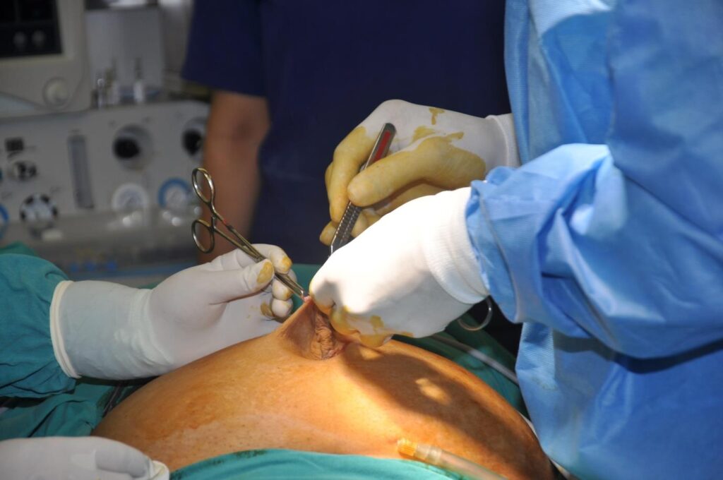 General Surgery - VIMS-College