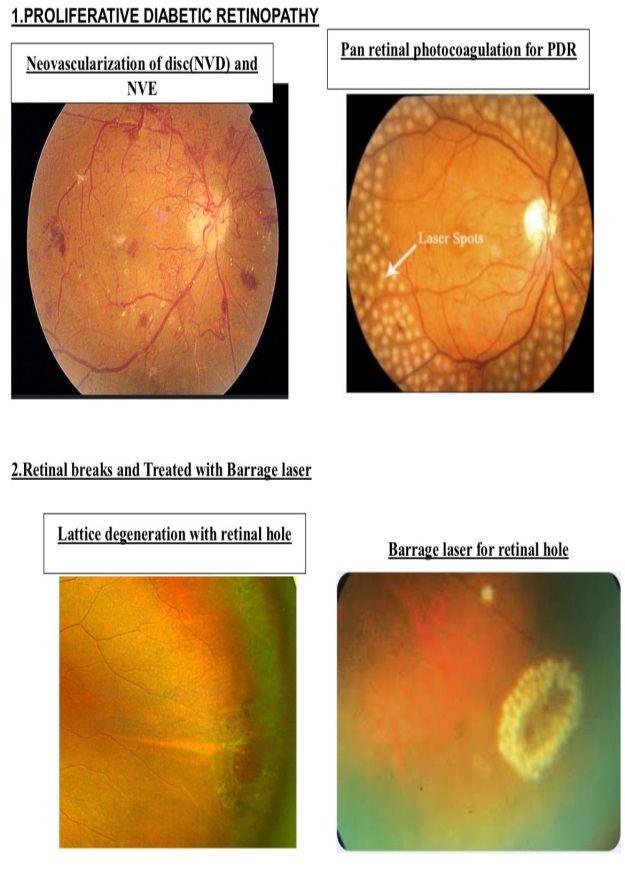 Ophthalmology - VIMS-College