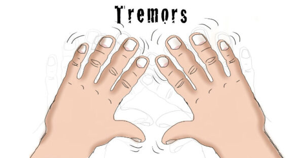All About Essential Tremors - VIMS