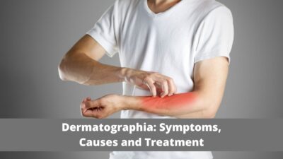 Dermatographia: Symptoms, Causes and Ayurvedic Treatment - VIMS