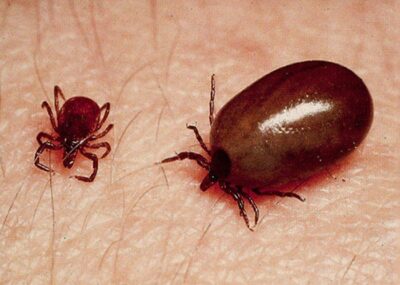Scrub Typhus Disease Symptoms, Diagnosis and Treatment - VIMS