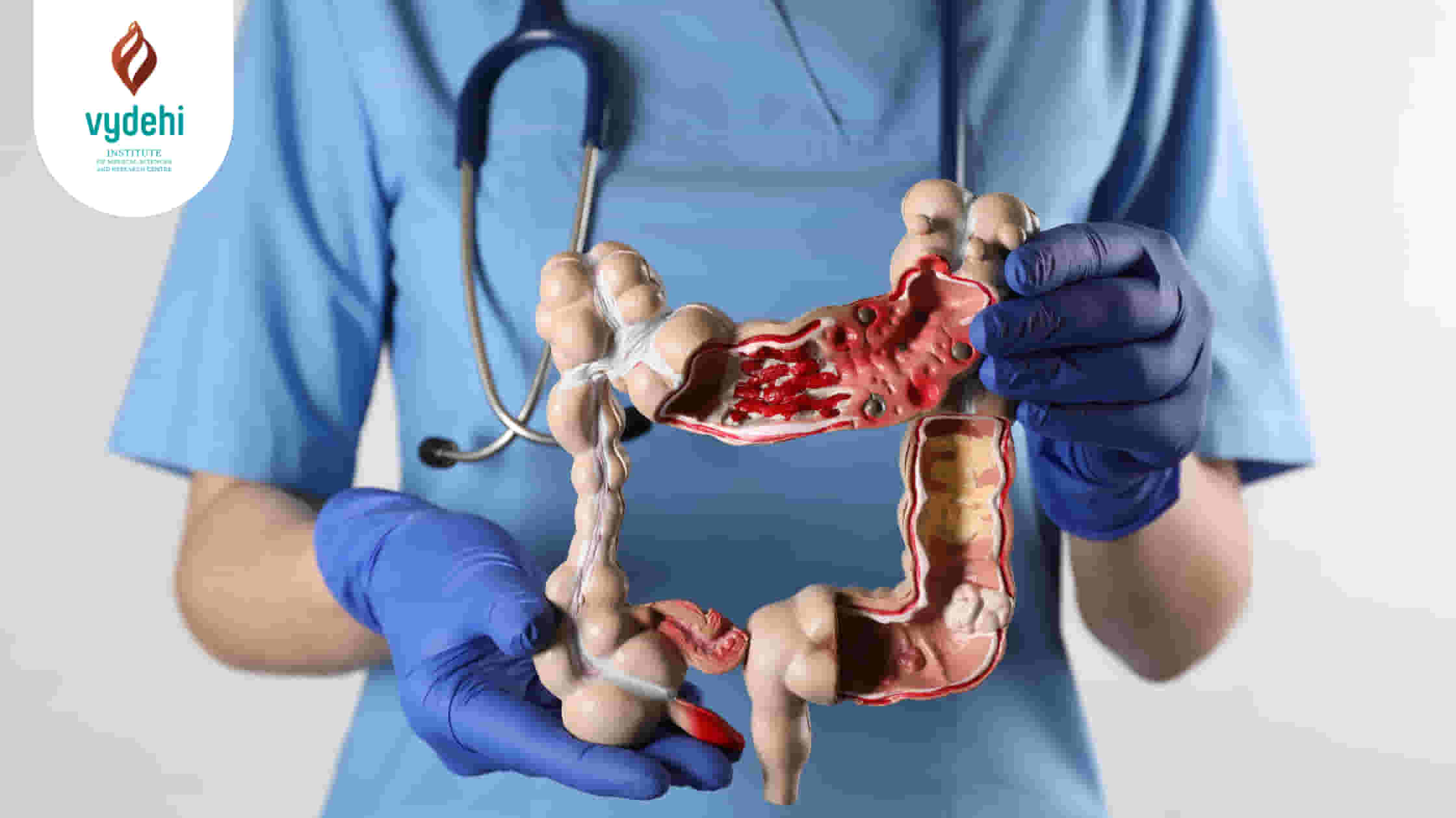 Best Gastroenterology Hospital in Bangalore | Vydehi Hospital