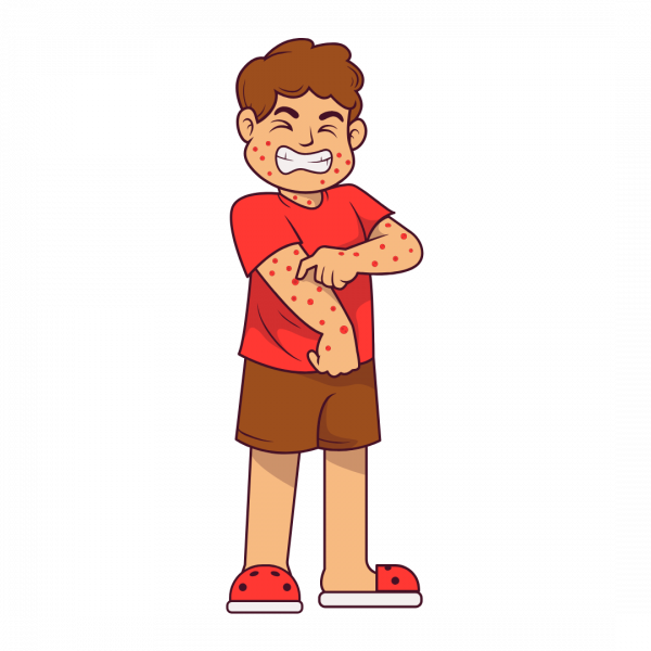 Myths: Separating Fact from Fiction About Chicken Pox | VIMS&RC