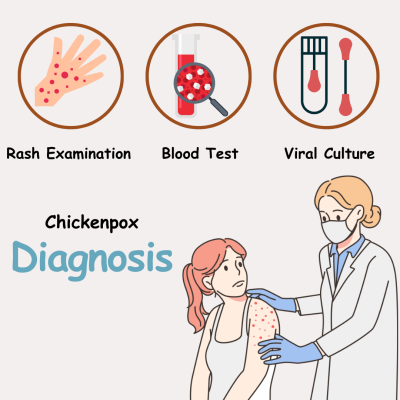 Myths: Separating Fact from Fiction About Chicken Pox | VIMS&RC