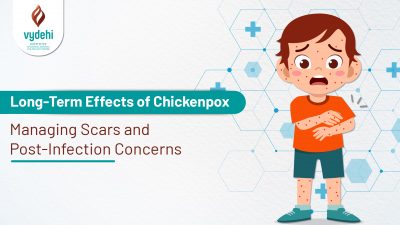 Chickenpox Scars: Minimizing Marks & Regaining Confidence