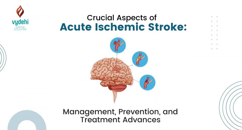 Acute Ischemic Stroke: Symptoms, Treatment & Prevention